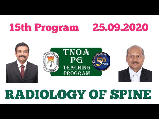 TNOA Video of the day - 30/11/2023 : RADIOLOGY OF SPINE - Tamilnadu ...