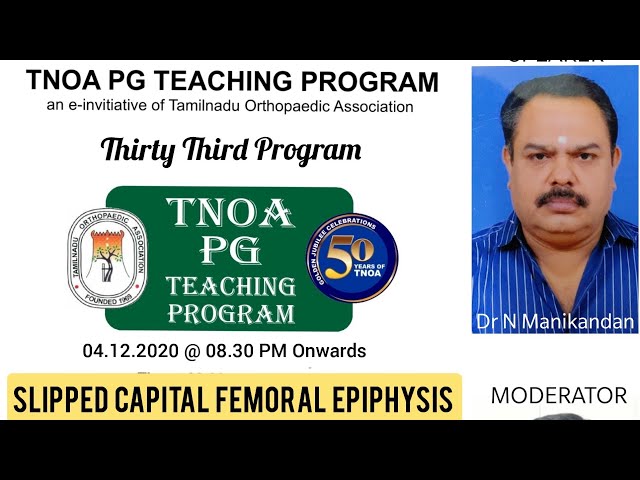 TNOA Video of the day - 23/12/2023 : SLIPPED CAPITAL FEMORAL EPIPHYSIS ...